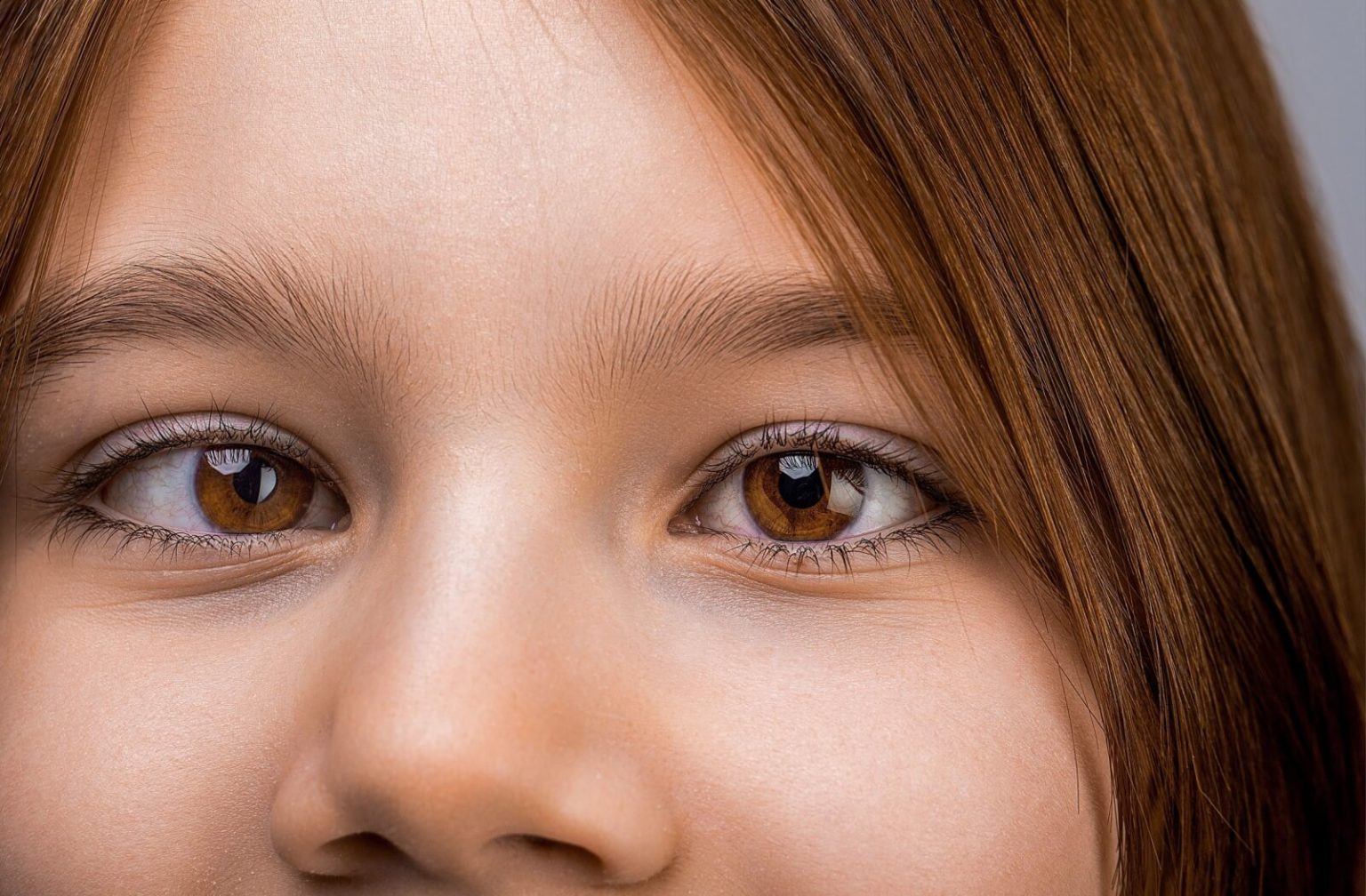 When Should You Worry About Your Child’s Crossed Eyes?